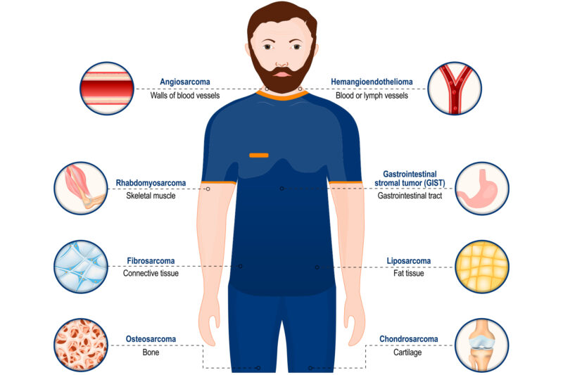 Sarcoma Cancer Awareness Month - Signature Health Services